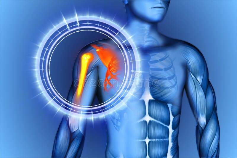 Ombro - Tendões E Músculos Da Omoplata Ilustração Stock - Ilustração de ...