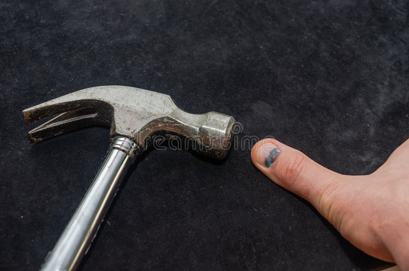 Clavo De Dedo Herido Por Martillo Imagen de archivo - Imagen de ...