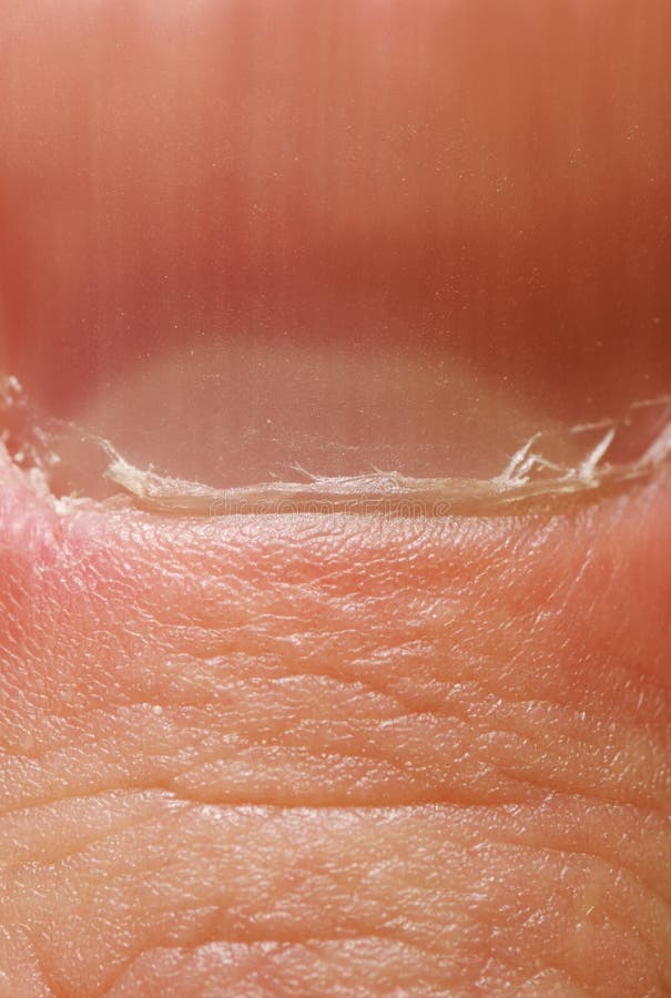 Clavo del dedo imagen de archivo. Imagen de montante - 27885633