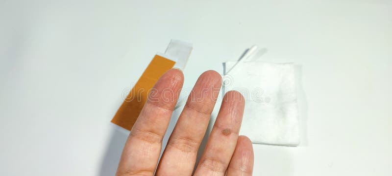 Clavus on a Human Finger. Dermatology Problem Stock Image - Image of ...