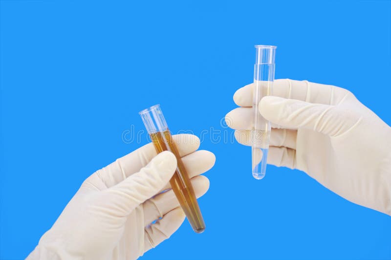 Clean and Dirty Water Samples Stock Photo - Image of biology ...