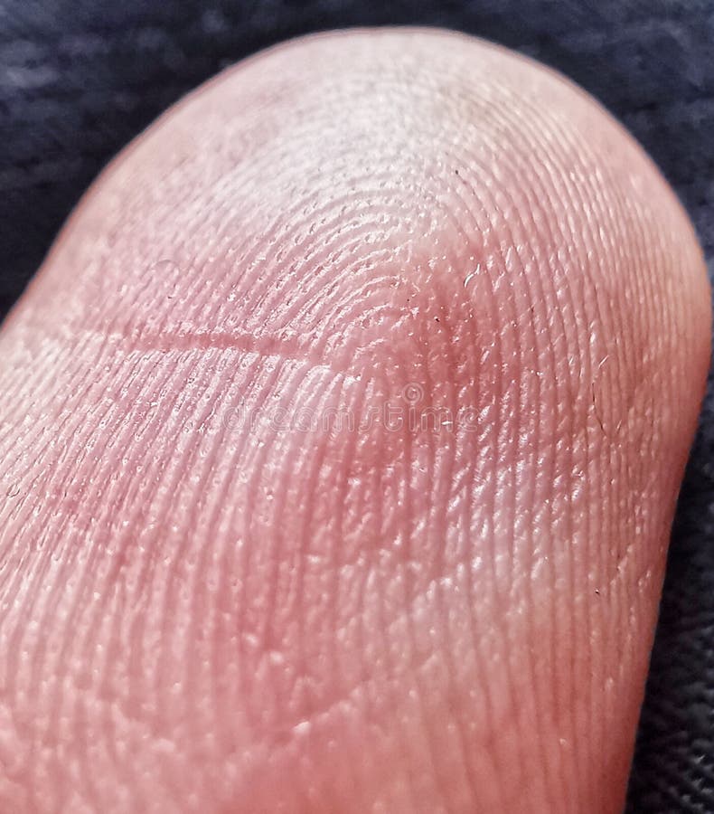 Clean Fingerprints without Germs Stock Photo - Image of fingerprints ...