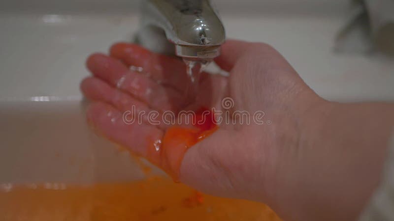 Cleaning Bleeding Hand after Accident in Sink Stock Video - Video of ...