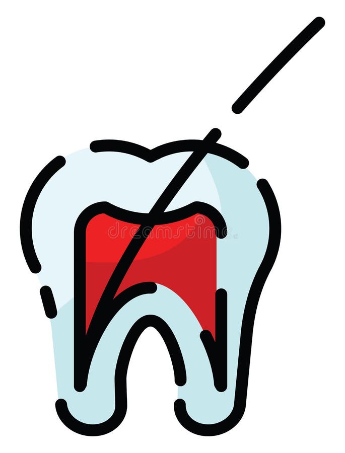 Molar Roots Stock Illustrations – 578 Molar Roots Stock Illustrations ...