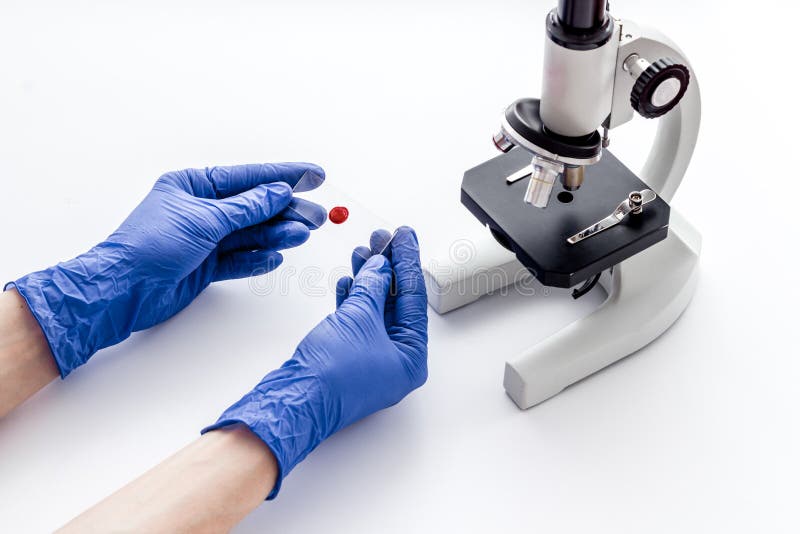 Clinical Science Research with Microscope. Blood Sample in Hands on ...