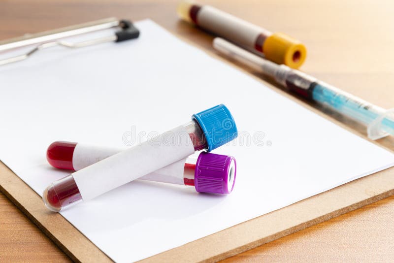 Clinical Work Table with Blood Test Tubes and Syringe Stock Image ...