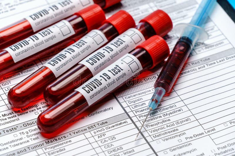 Clipboard with Paper Blank Form with Blood Test Tubes on White ...