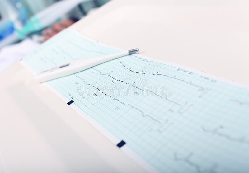 Clock Surveillance of Patient Stock Photo - Image of expertise ...