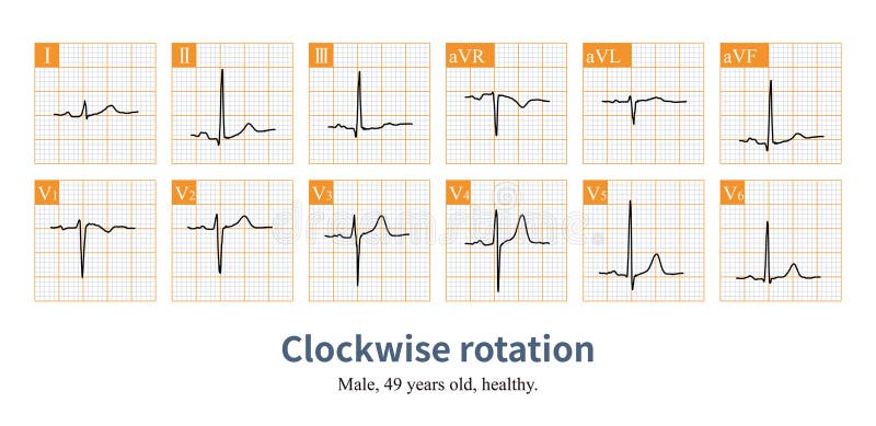 Rotation Electrocardiogram Stock Photos - Free & Royalty-Free Stock ...