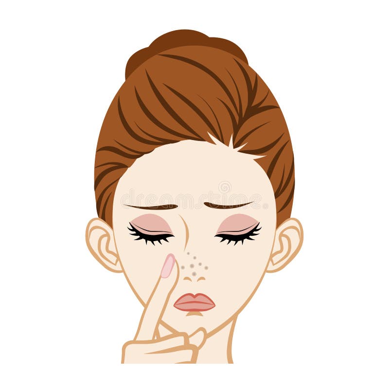 Clogged Nose Pore -Skincare Trouble Stock Vector - Illustration of care ...