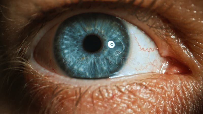 Dyshidrotic Eczema on the Foot, Dermatitis. a Man Dabs a Deflated ...