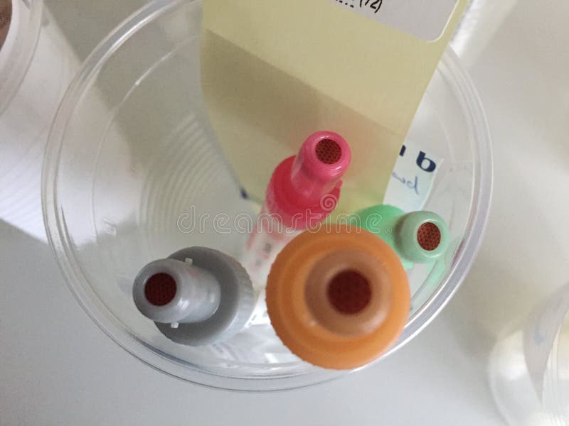 Close Up Above View of Different Blood Test Tubes in Plastic Cup Stock ...