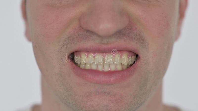 Close Up of Angry Young Man Crunching Teeth Stock Photo - Image of male ...