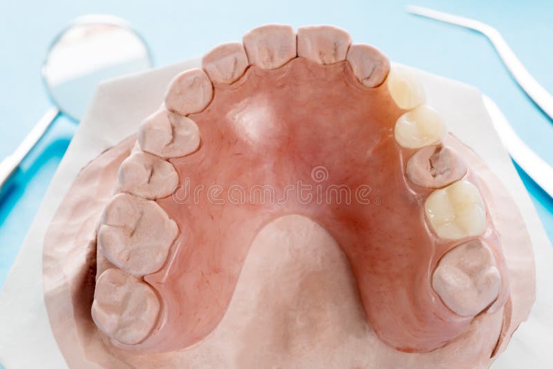 Artificial Removable Partial Denture. Stock Image - Image of equipment ...