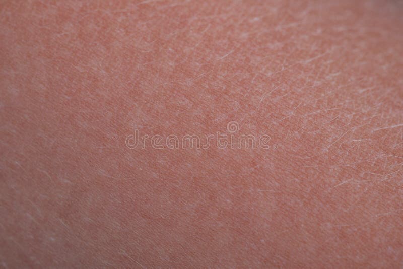 Human skin stock image. Image of background, textured - 17108889