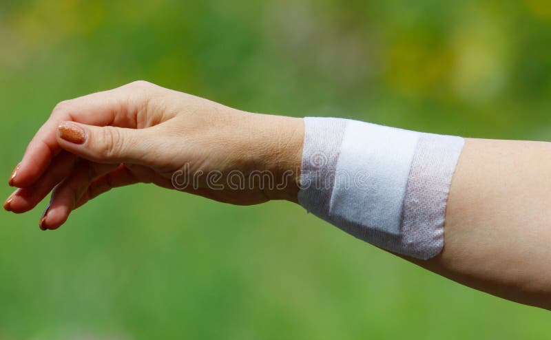 Close-up of a Bandaged Hand Stock Photo - Image of hurt, bandage: 333440800
