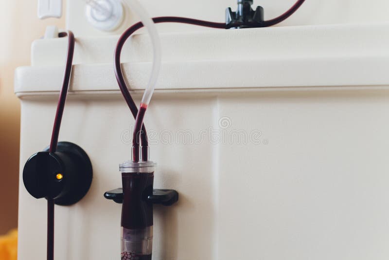 Close Up of Blood Extraction in Lab. Stock Photo - Image of donation ...