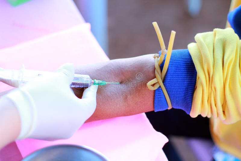Close Up of Blood Extraction in Lab Stock Photo - Image of bank ...