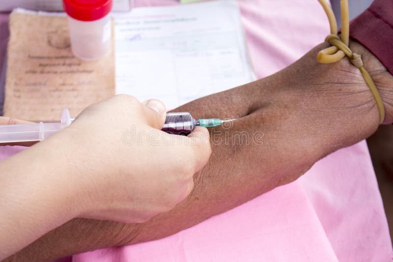 Close Up of Blood Extraction in Lab Stock Image - Image of nurse ...
