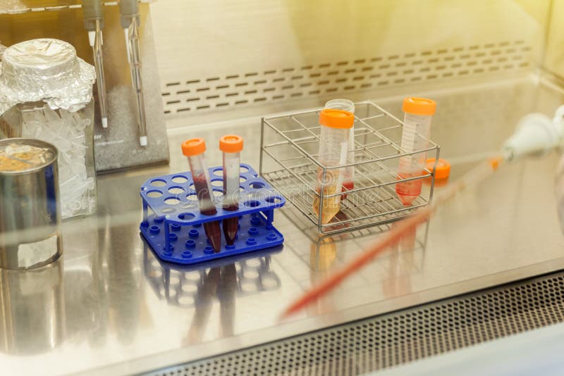 Blood Sample in Plastic Tube Stock Image - Image of hospital ...