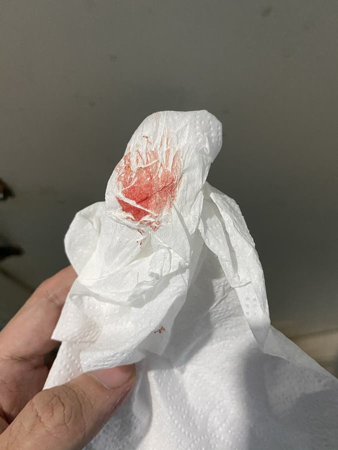Blood in tissue paper stock photo. Image of emergency - 205890690