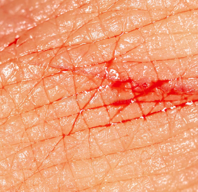 1,998 Blood Scratch Photos - Free & Royalty-Free Stock Photos from ...