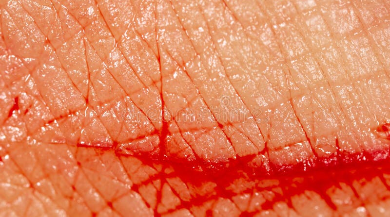 Close-up of Blood from a Wound on a Human Skin Stock Photo - Image of ...
