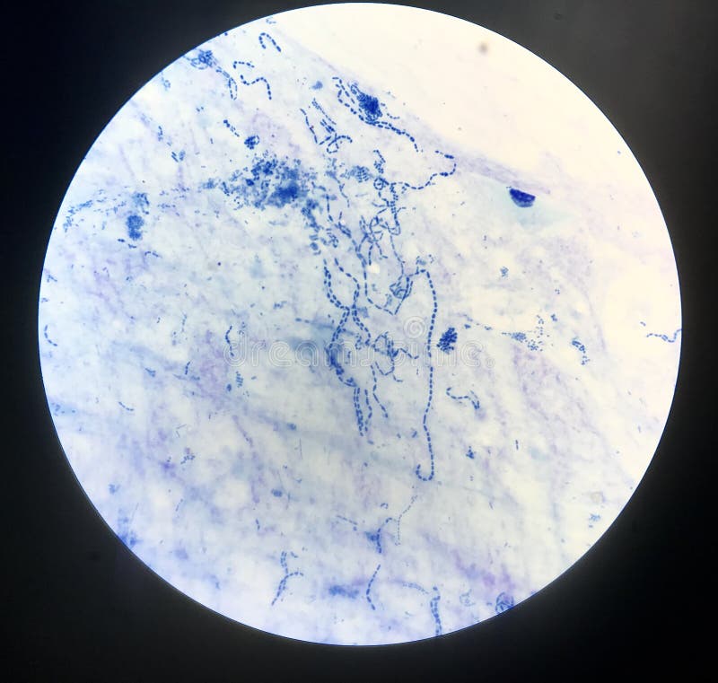 Bacteria Cells Finding with Microscope. Stock Image - Image of blue ...