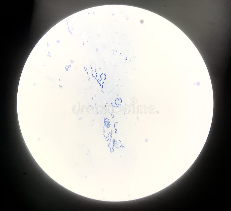 Blue bacteria cells stock photo. Image of genetic, disease - 96653064