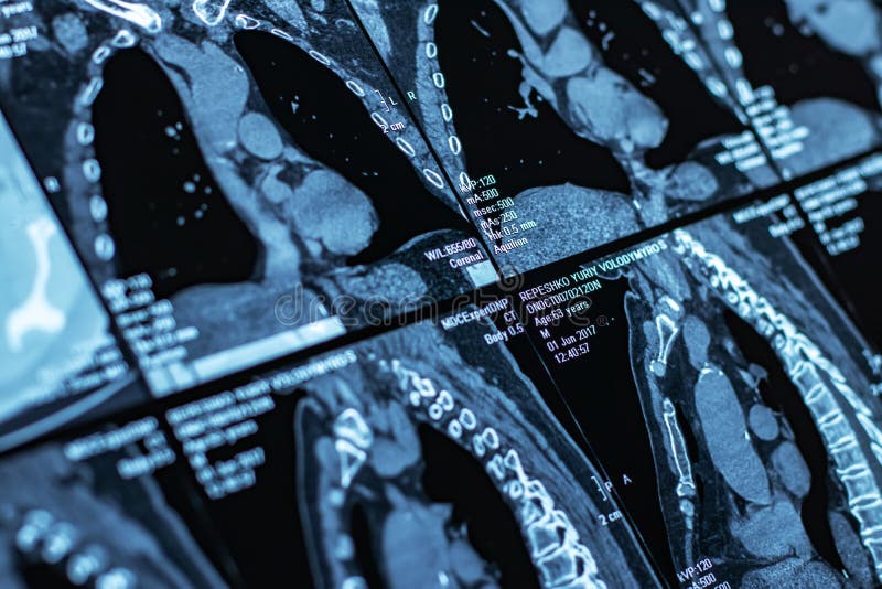 Close Up of a Body CT Scan Background Stock Image - Image of structure ...