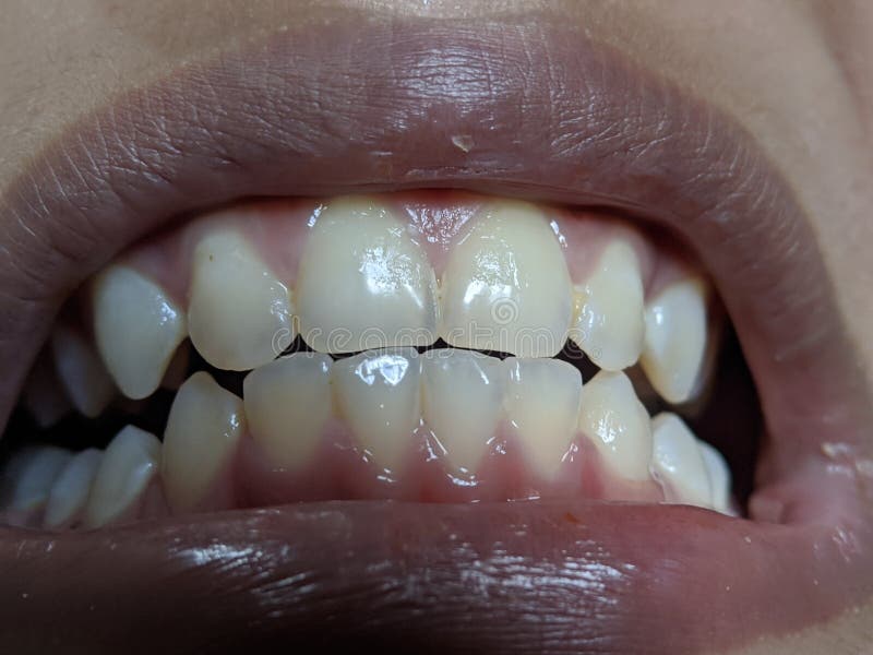 Close-up of Boy Teeth Texture Stock Image - Image of close, mouth ...