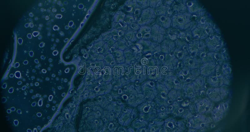 Cancer Cells Under Microscope at Laboratory Stock Footage - Video of ...