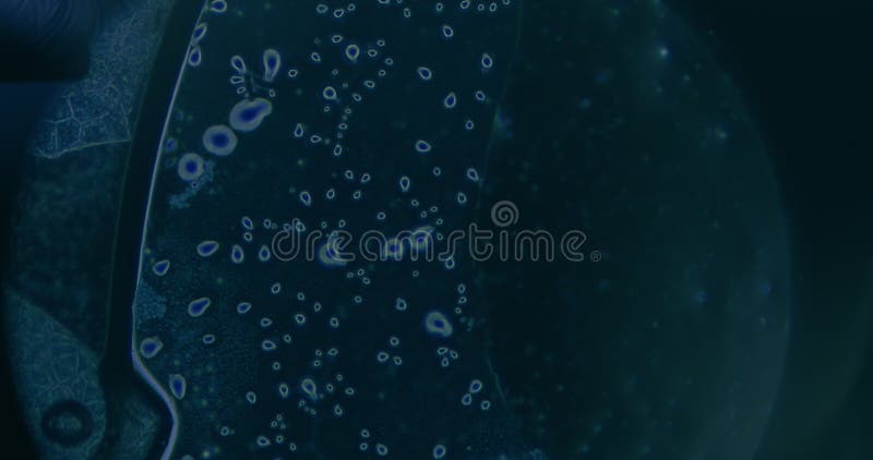 Cancer Cells Under Microscope at Laboratory Stock Video - Video of ...