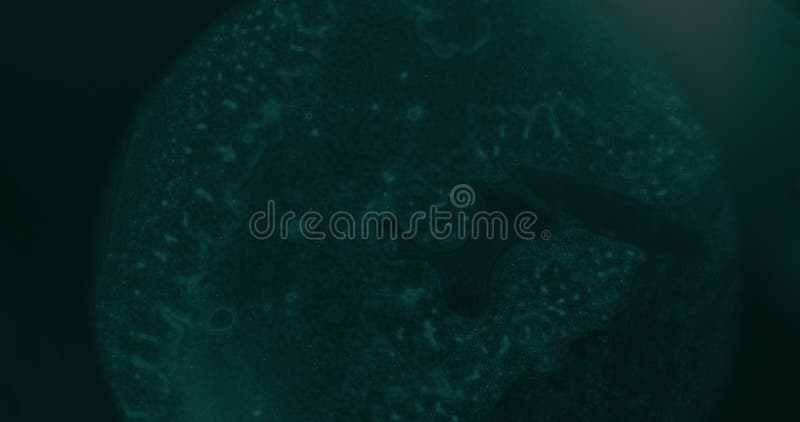 Cancer Cells Under Microscope at Laboratory Stock Video - Video of ...