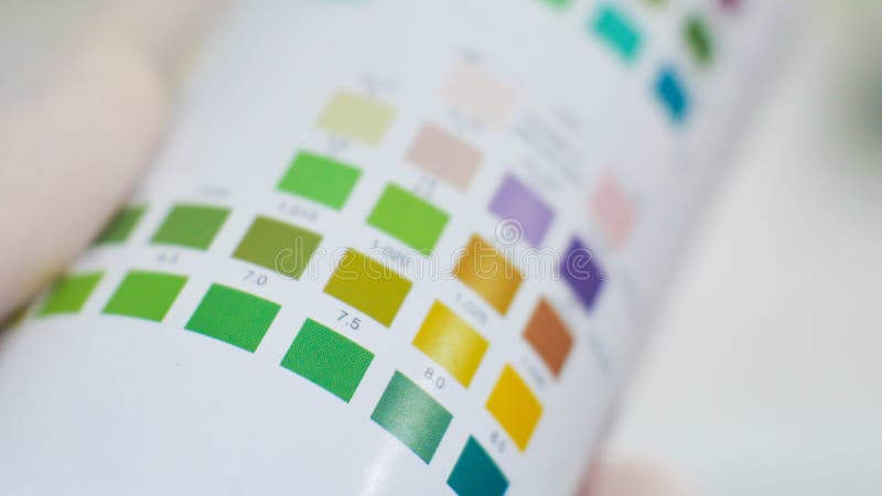 Close Up Color Level in Urine Strip Test Stock Photo - Image of ...