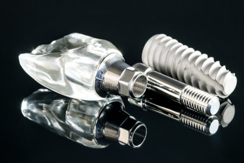 Dental implant model. stock photo. Image of prosthesis - 169816426