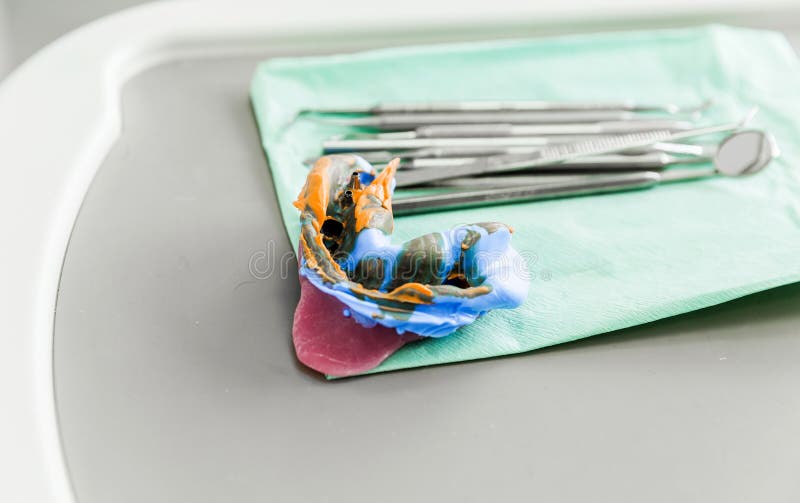 Close-Up of Dental Impression and Tools on Tray Stock Image - Image of ...