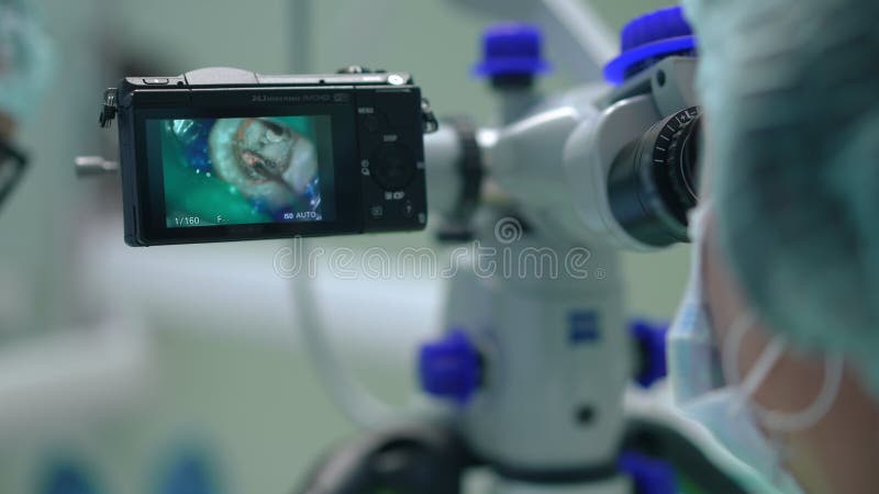 Close-up Dental Microscope Screen with Tooth Cavity and Blurred Doctor ...