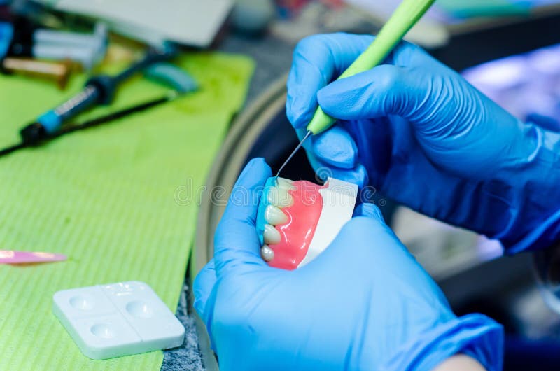 Close-up of Denture Manufacturing Process. Tooth Reconstruction Stock ...
