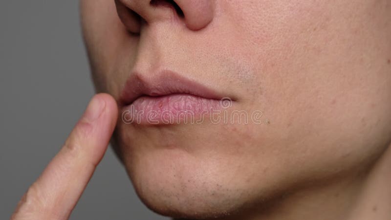 Close Up of Dry Lips of an Young Man. Guy Touching His Dry Lips with a ...