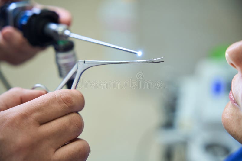 Close-up of Ear Examination Tool in Doctors Hands Stock Photo - Image ...