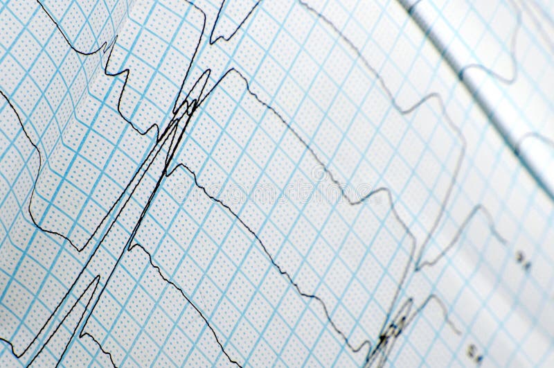 Close-up of ECG graph stock image. Image of disease, cardio - 3661543