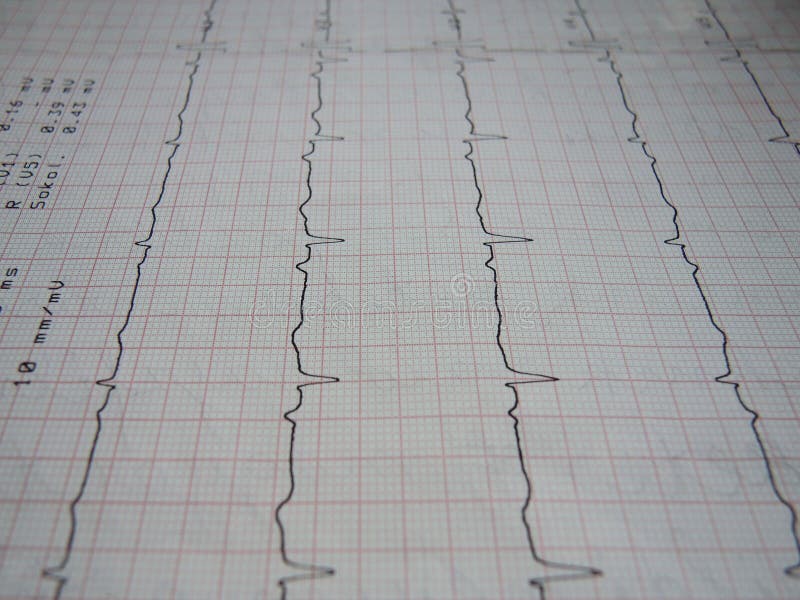 Close up of ECG graph stock image. Image of checkup, graph - 78909707