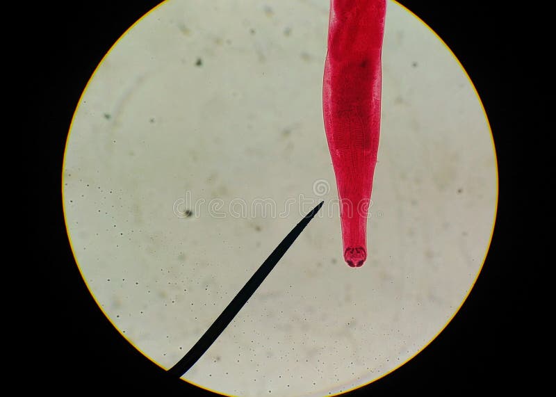 Close Up Egg with Adult of Parasite. Stock Image - Image of meat ...