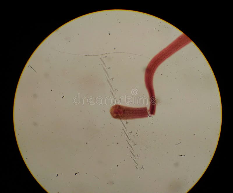 Close Up Egg with Adult of Parasite. Stock Image - Image of science ...