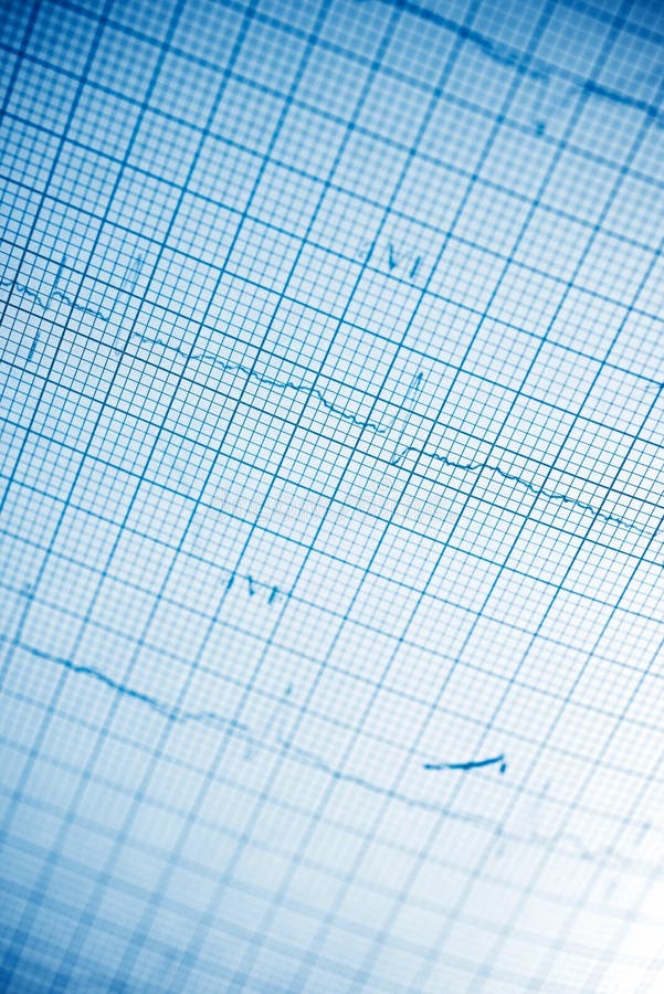 Close-up of an Electrocardiogram Printed on Blue Paper Stock Image ...