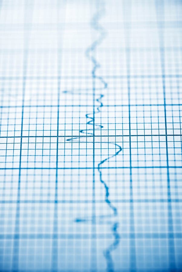 Close-up of an Electrocardiogram Printed on Blue Paper Stock Image ...