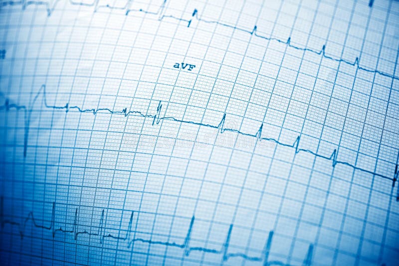 Close-up of an Electrocardiogram Printed on Blue Paper Stock Image ...