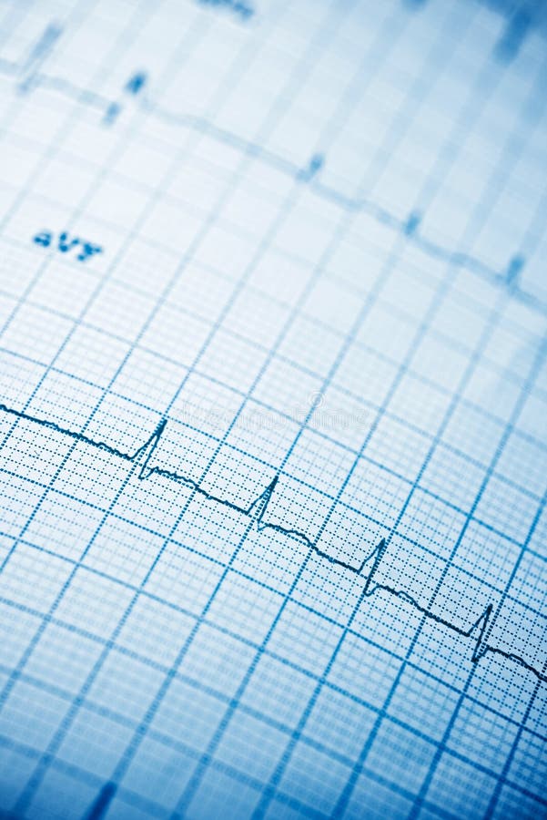 Close-up of an Electrocardiogram Printed on Blue Paper Stock Image ...