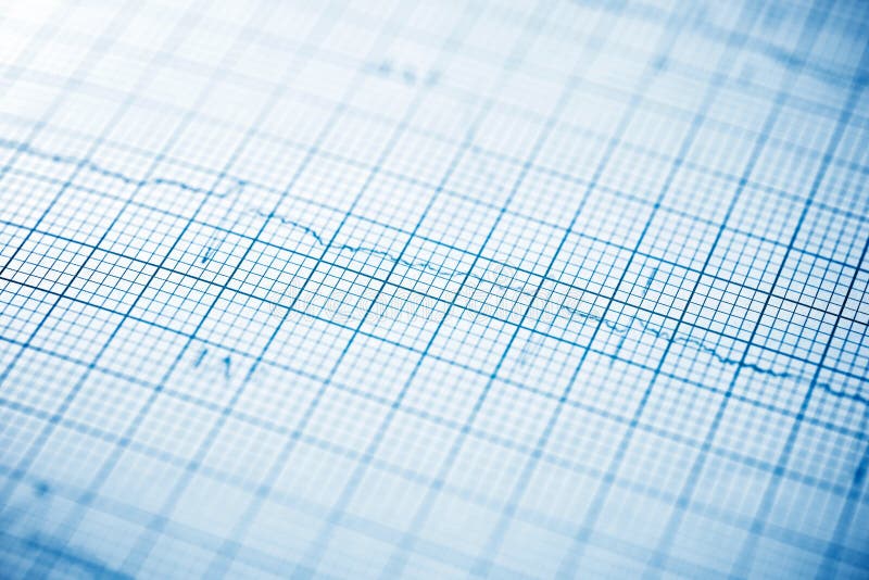 Close-up of an Electrocardiogram Printed on Blue Paper Stock Image ...